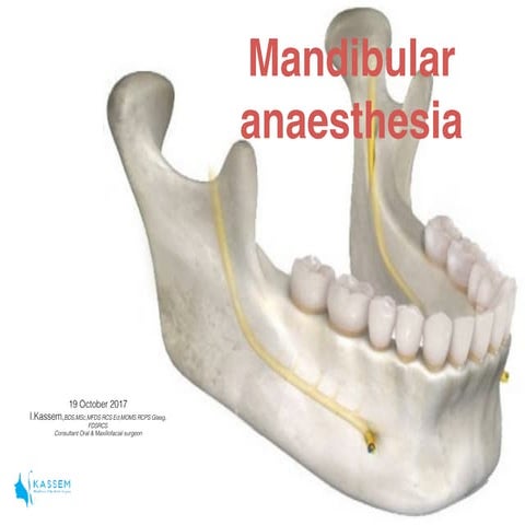 Inferior Alveolar Nerve Block | PPT