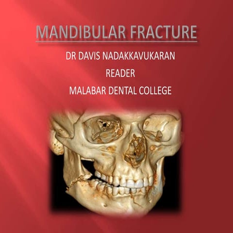MANDIBULAR FRACTURE.pptx