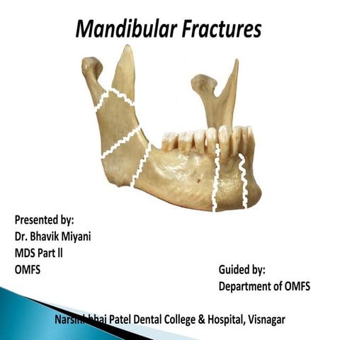 Mandibular fracture 3 / fixed orthodontic courses