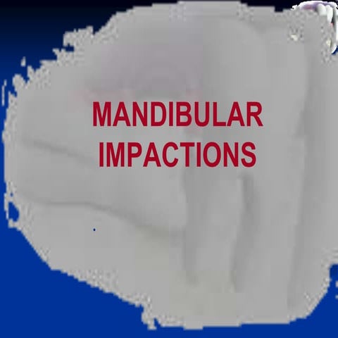 THIRD MOLAR IMPACTION (BASIC) | PPTX