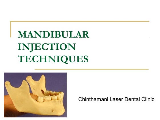 Inferior alveolar nerve block | ODP | Dental Health | Diseases and ...