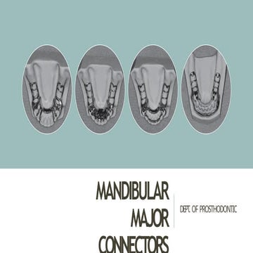 Mandibular Major Connectors | PPTX