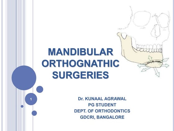 Mandibular osteotomies | PDF | Dental Health | Diseases and Conditions
