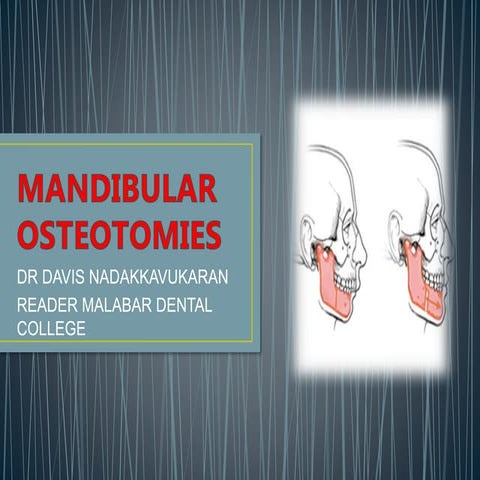 MANDIBULAR OSTEOTOMIES.pptx
