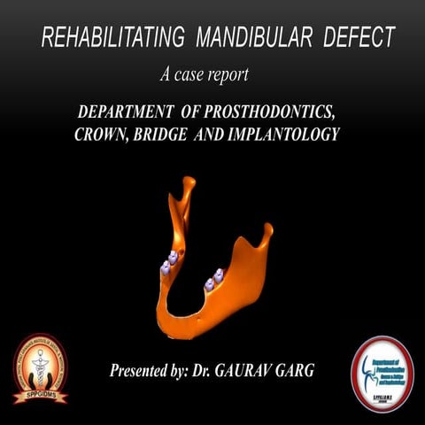mandibular recnstruction.ppt | Dental Health | Diseases and Conditions