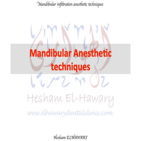 Maxillary nerve block anesthetic technique (with photos) | PDF