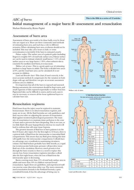 Fluid calculation for burn | PPT | First Aid | Injuries
