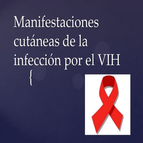 PRESENTACION SOBRE VIH - SIDA (LO MÁS IMPORTANTE).pptx