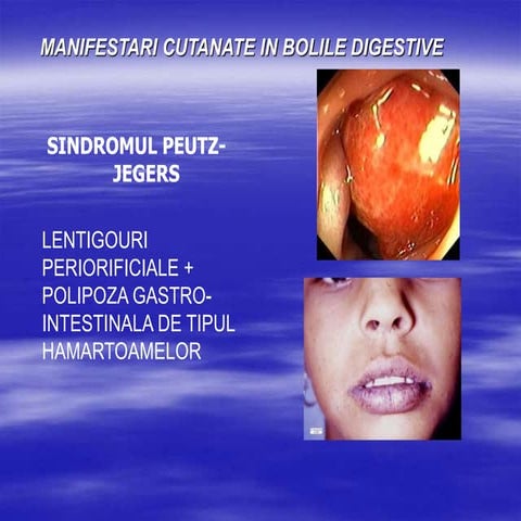 Manifestari cutanate in bolile digestive | PPT