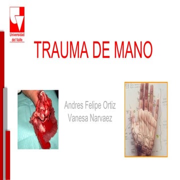 Trauma de mano | PPTX