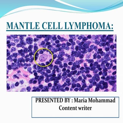 Lymphoma Slide