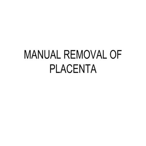 Manual removal of placenta | PPT