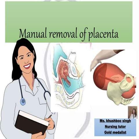 MANUAL REMOVAL OF PLACENTA. | PPT