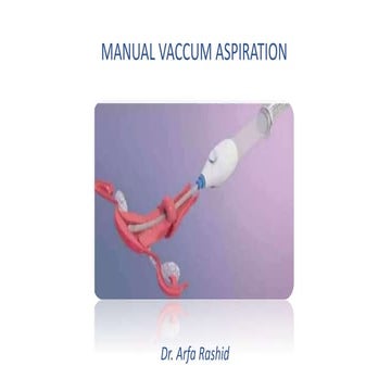 Manual Vaccum Aspiration- A step by step guide. | PPTX