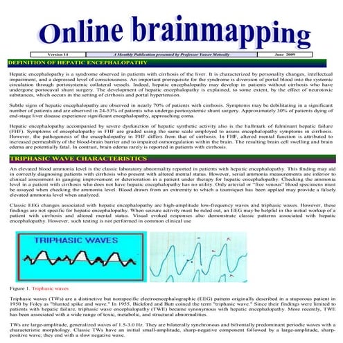 Triphasic waves in EEG | PPTX