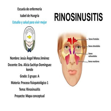 RINOSINUSITIS. enfermedad que altera los senos de la cara | PPTX