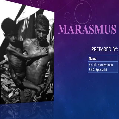 Marasmus a short description | PPT | Nutrition | Healthy Living