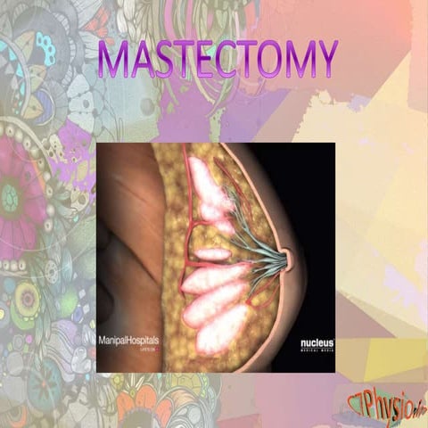 Modified radical mastectomy | PPTX