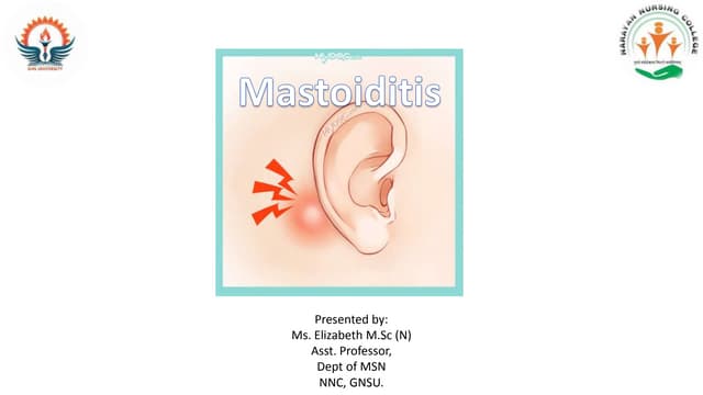Mastoiditis | PPTX