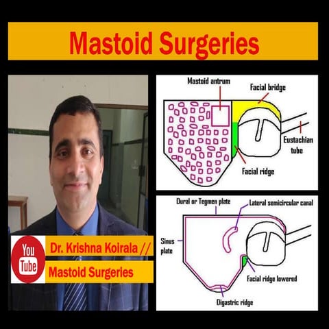 Mastoid surgeries KK .ppt