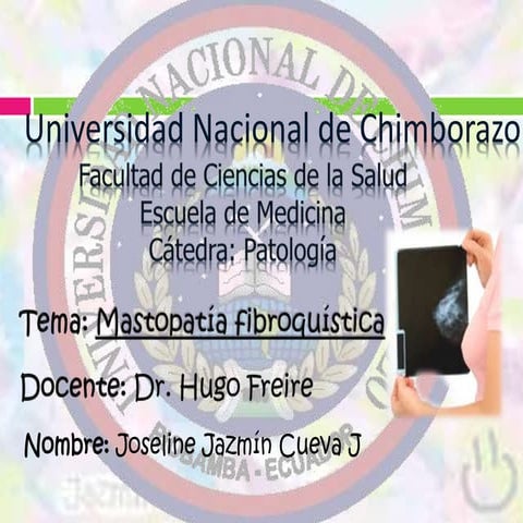 SEMIOLOGIA DE LAS MAMAS. DR, HANMER ROA. 2020 | PPTX