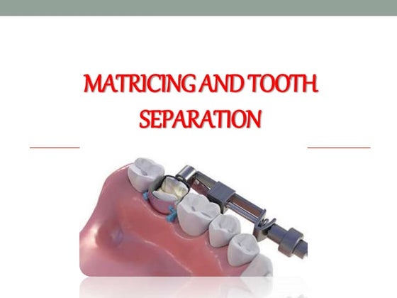 Types Of Matrix Retainer & Parts Of Retainer | PPT | Dental Health ...