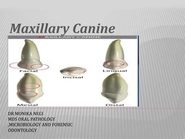 Permanent Maxillary 1st premolar | PPTX