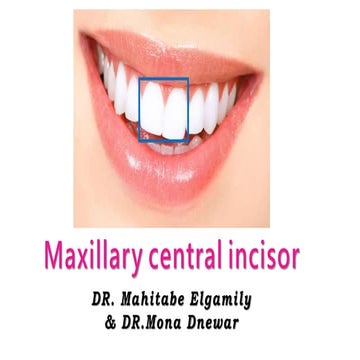 Maxillary central incisor | PPTX