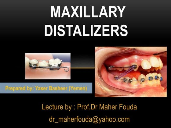 Class III Malocclusion | PDF