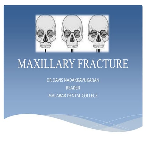MAXILLARY FRACTURE.pptx