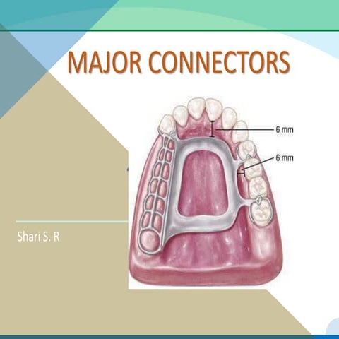 MAXILLARY MAJOR CONNECTOR.pptx