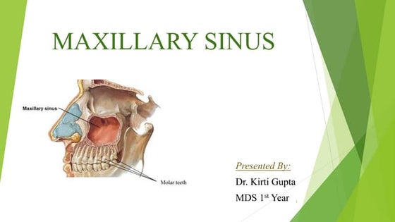 radiology of Maxillary sinus | PPT