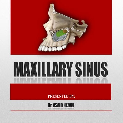 Maxillary Sinus Pptx