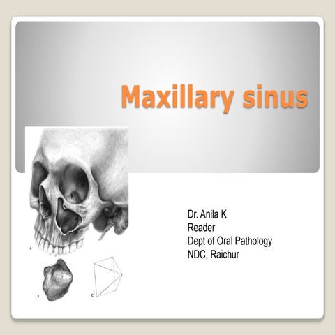 Maxillary sinus.ppt