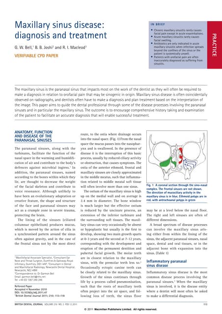 Assessment of maxillary sinuss.pptx