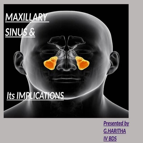 17. Maxillary sinus, antrum of highmore, surgical anatomy | PPTX