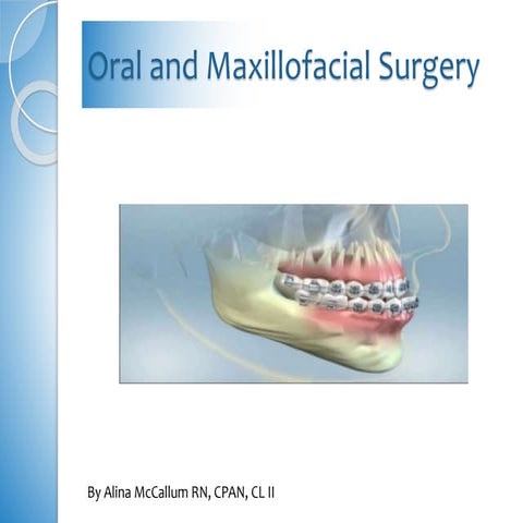 Maxillary surgery | PPTX