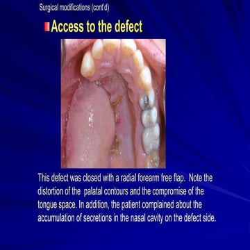 maxillofacial prosth..pptx | Dental Health | Diseases and Conditions