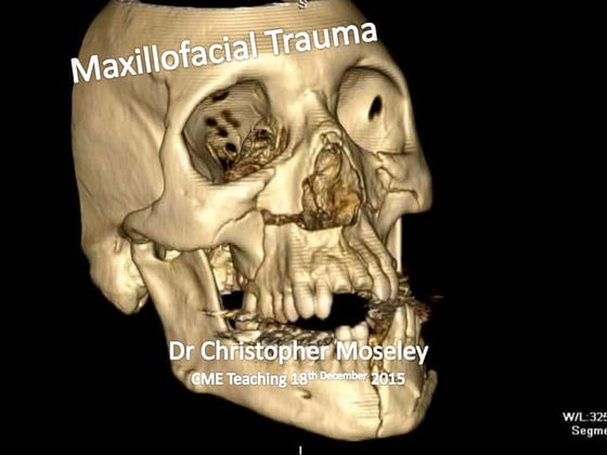 02 management of facial injury in a multi trauma | PPT