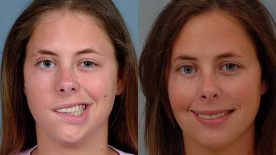 Dr. Alton Ingram MD | PPT