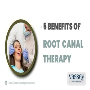 Benefits of Root Canal Therapy | PDF
