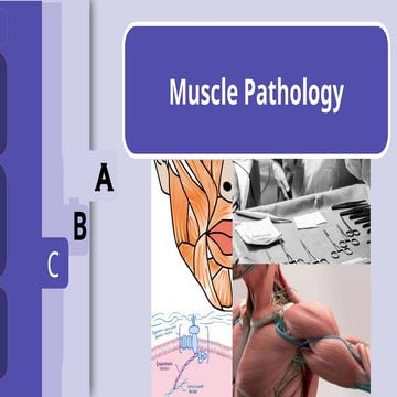 May 20 Muscle Pathology.pptx its a ppt | PPTX