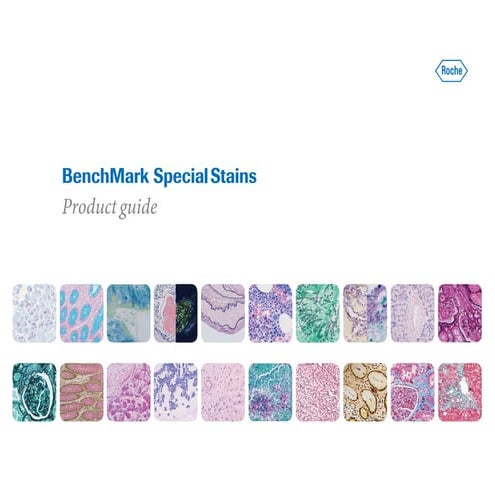 VENTANA BenchMark Special Stains General Reference Guide | PDF