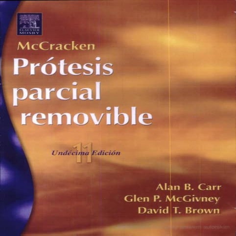 Prótesis Parcial Removible- Mckraken | PDF