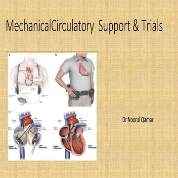 MCS.pptx mechanical circulatory su pport | PPTX
