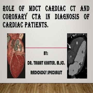 Mdct coronary | PPT