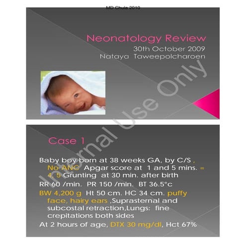 Mdcu Neonatology Review | PDF