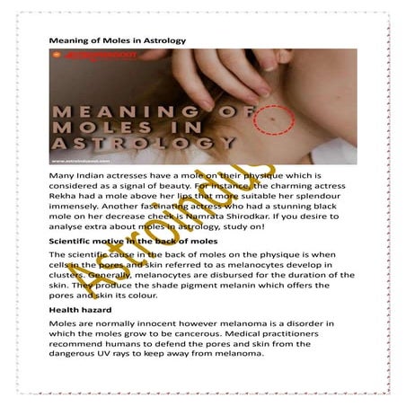 Meaning of Moles in Astrology.ppt