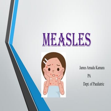 Measels.pptx77777777777777777777777777777 | PPTX