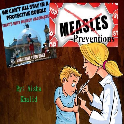 Measles- prevention | PPTX